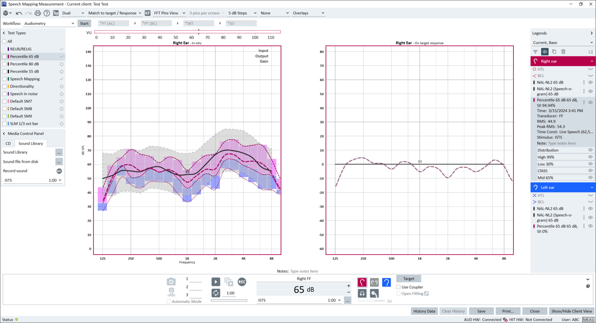 Speech mapping | Audio Service