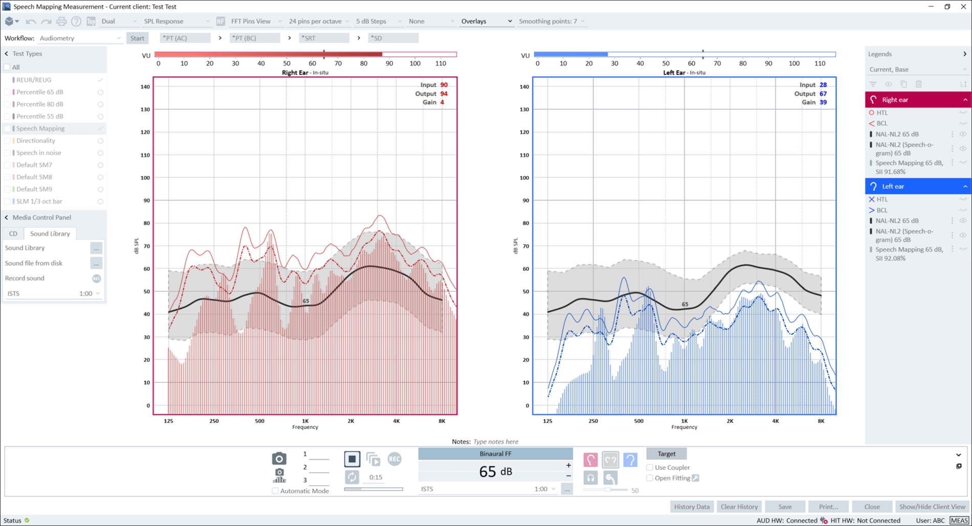 Speech mapping | Audio Service
